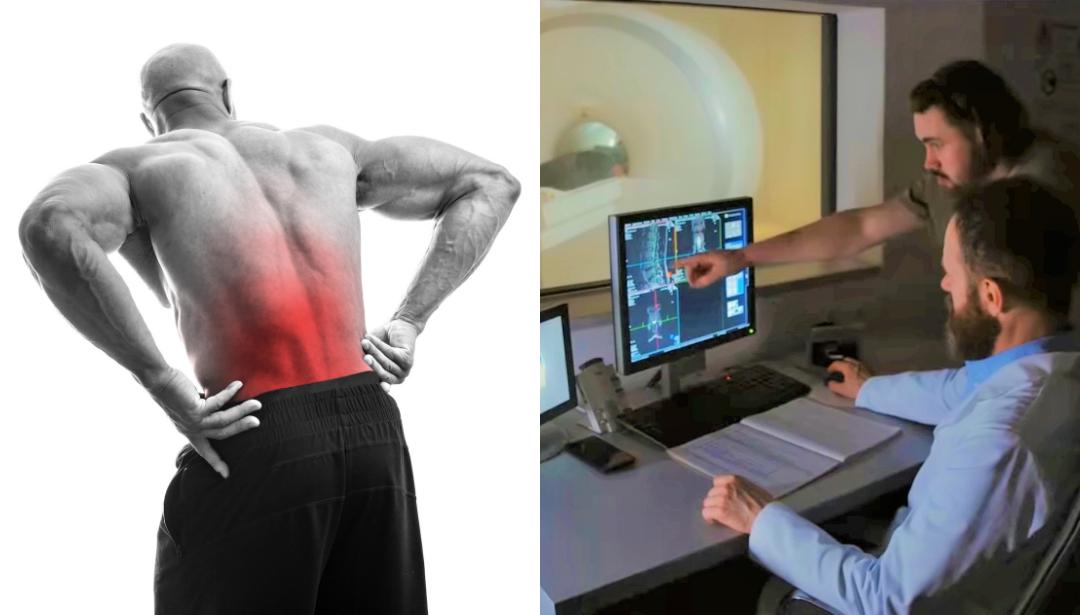 Spinal Imaging: MRI, CT & X-Ray for Back Pain in Hollywood, FL