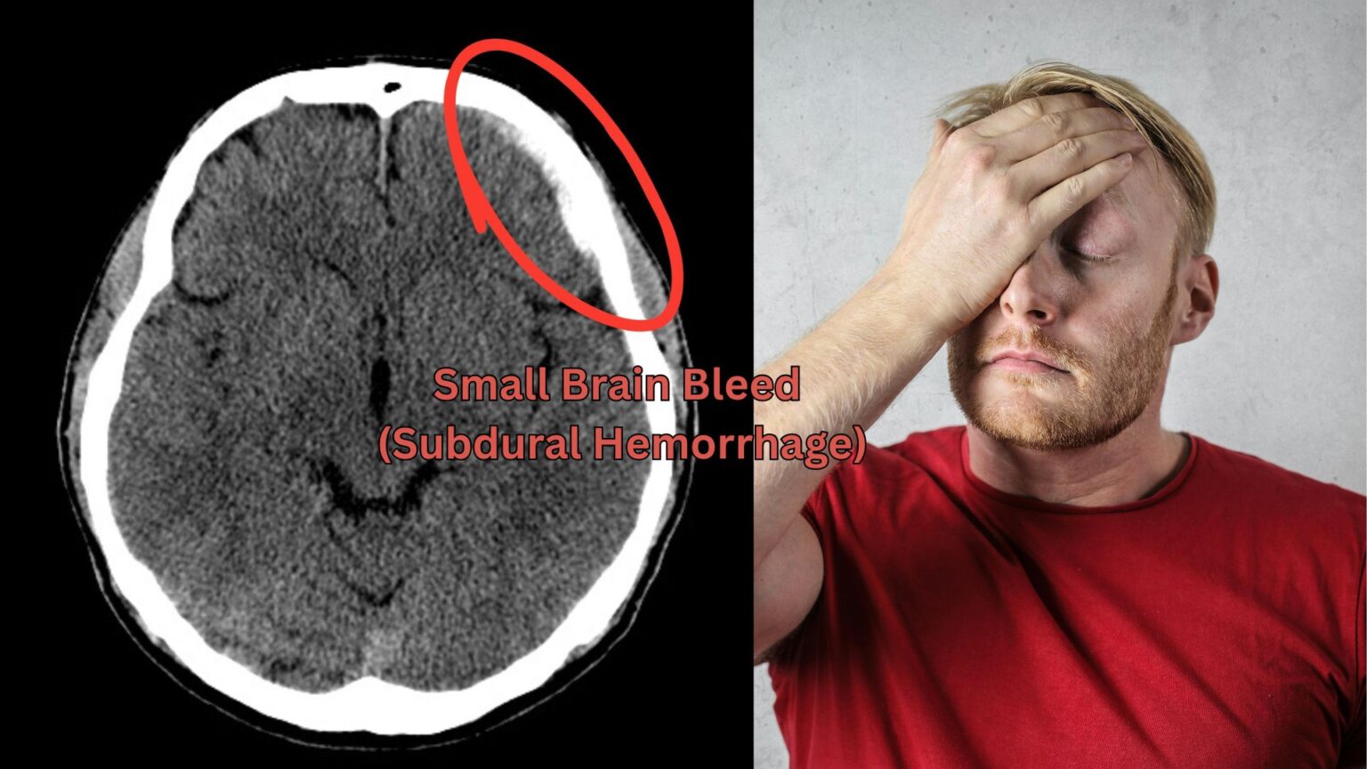 Head CT Scan Hollywood FL: Headaches, Injury & Brain Scans