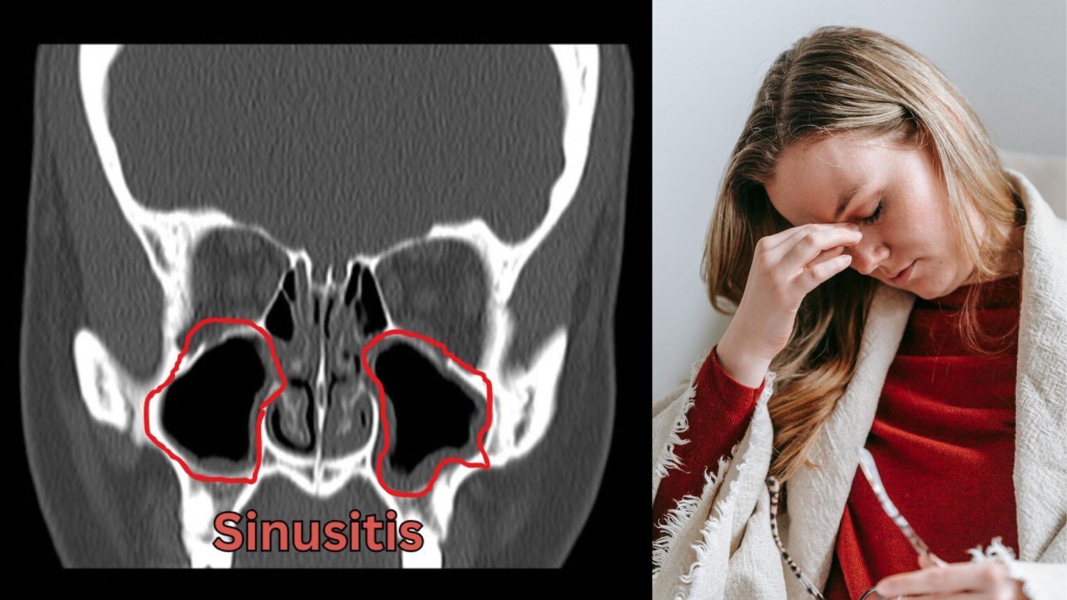 Sinus CT Scan Hollywood FL: Relief for Pain, Congestion, Sinusitis