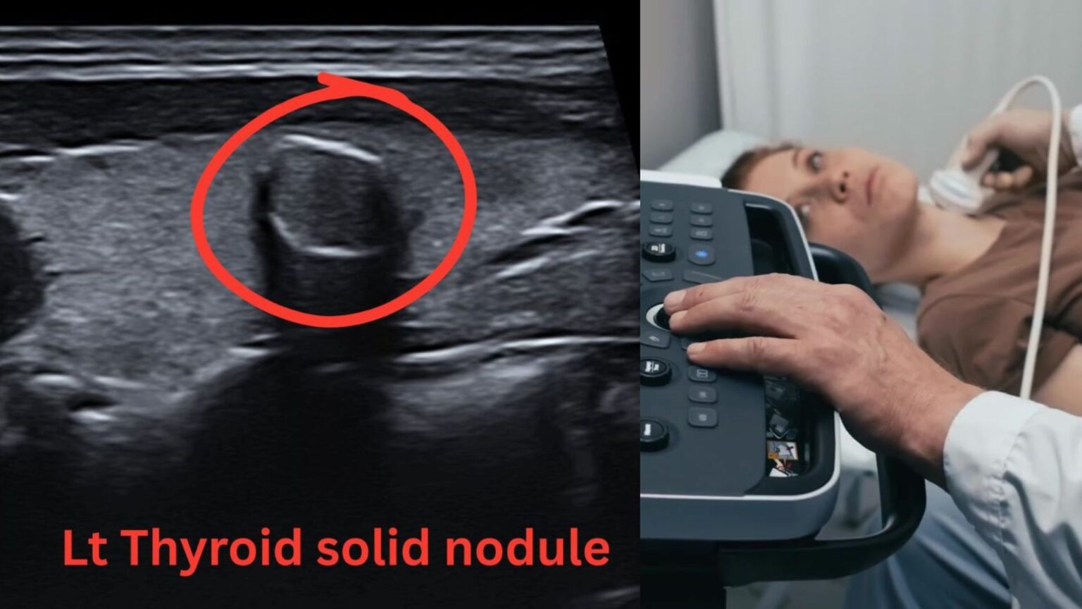 Thyroid Ultrasound Hollywood FL: Lumps & Goiter Scans